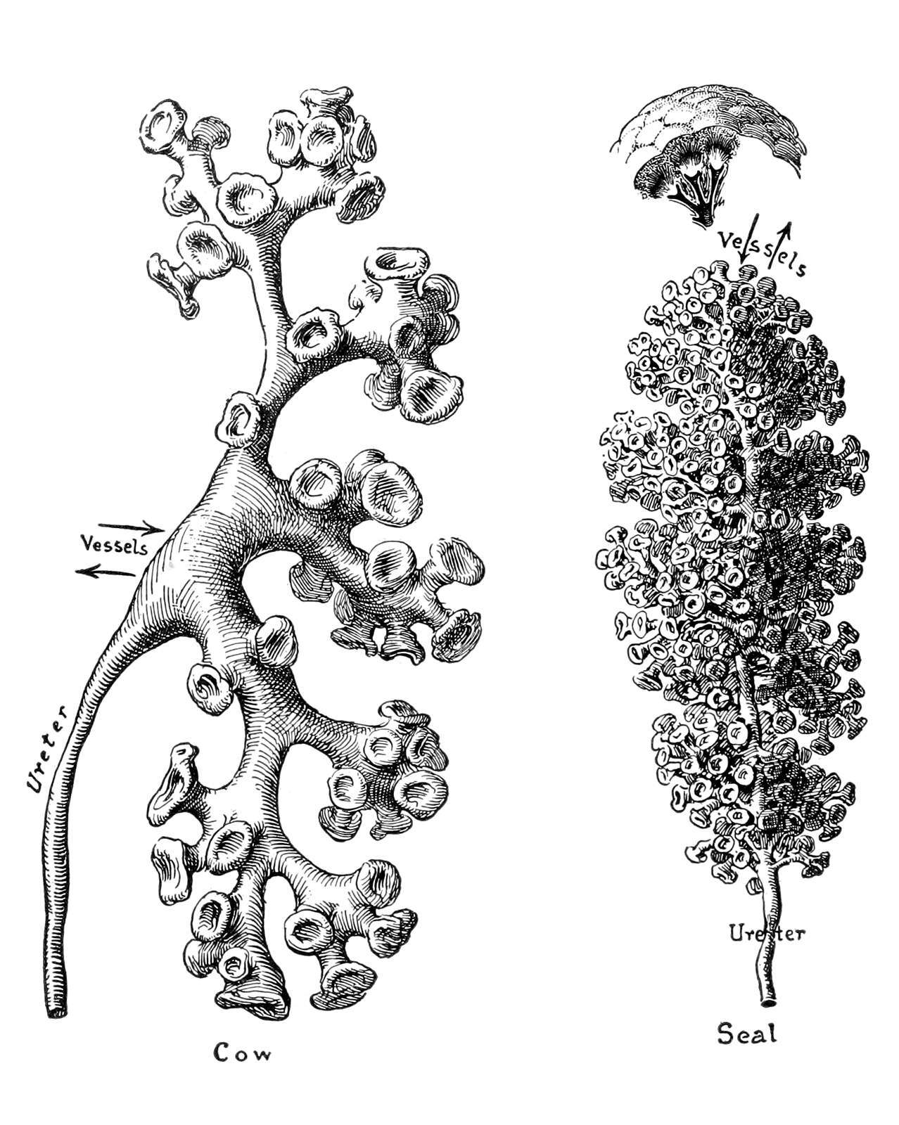 Casts of Renal Pelvis and Calyces – Old Book Illustrations
